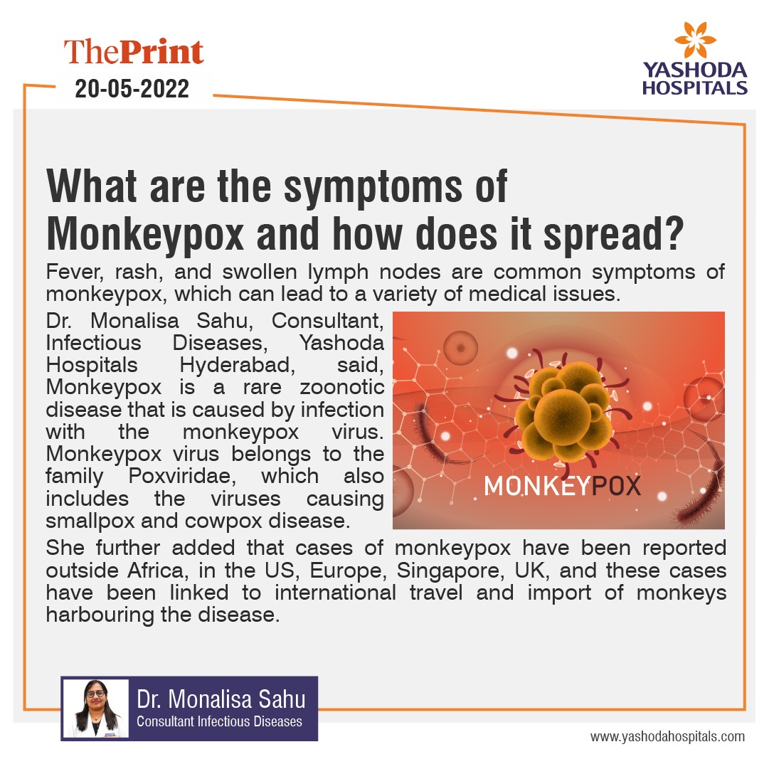 All you need to know about Monkeypox - Dr. Monalisa Sahu - Yashoda ...