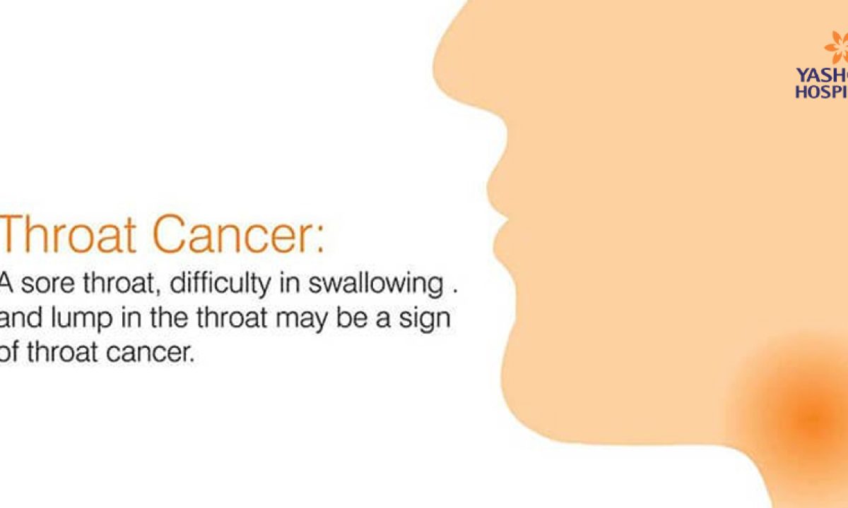 Lump In Throat Lump In The Back Of Throat : R/AskDoctorSmeeee