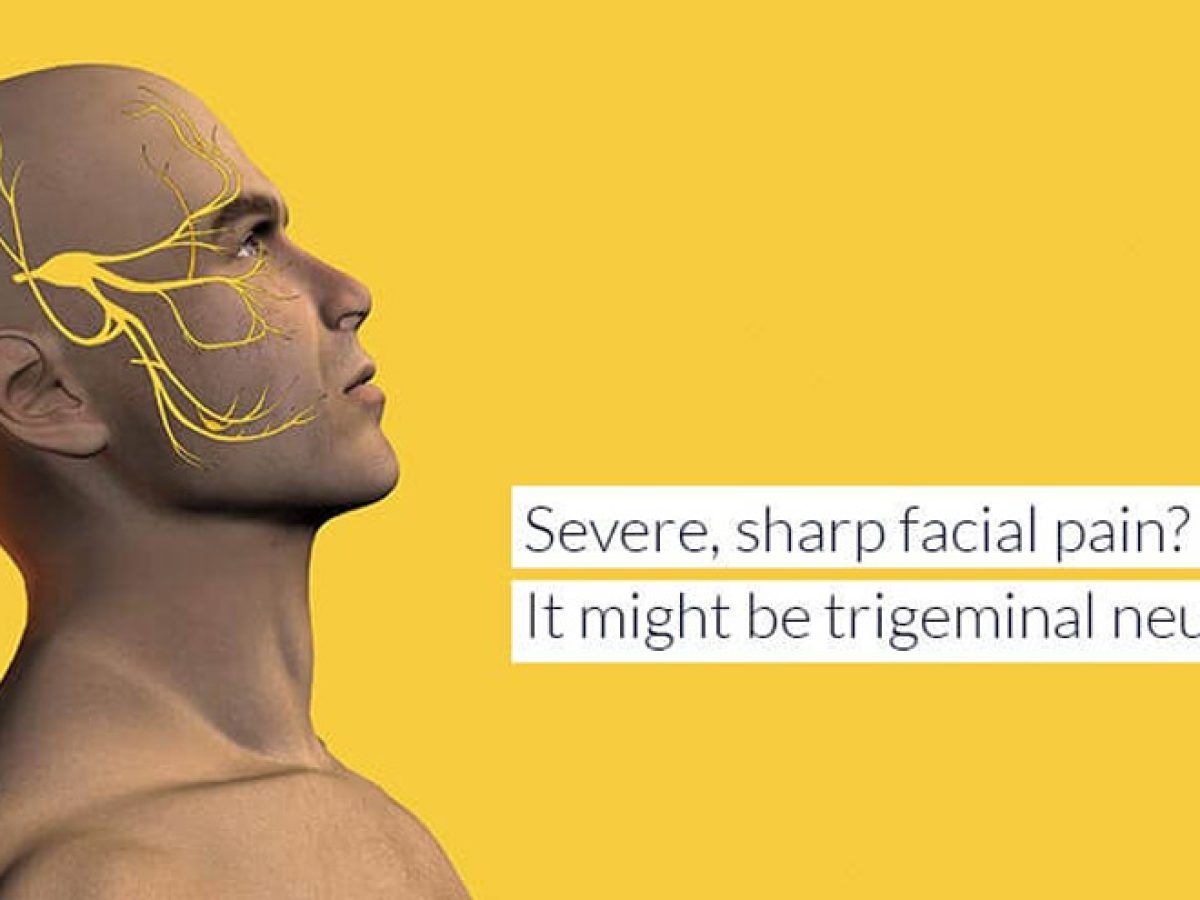 Your Complete Guide To Trigeminal Neuralgia A M Trigeminal Neuralgia