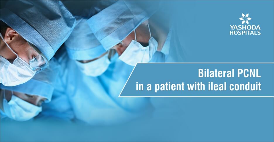 Bilateral PCNL in a patient with ileal conduit - Yashoda Hospitals