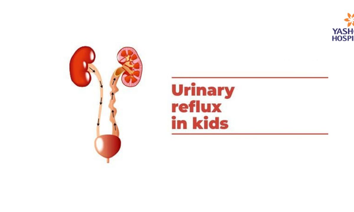 Vesicoureteral Reflux In Children Vesicoureteral Reflux Önol