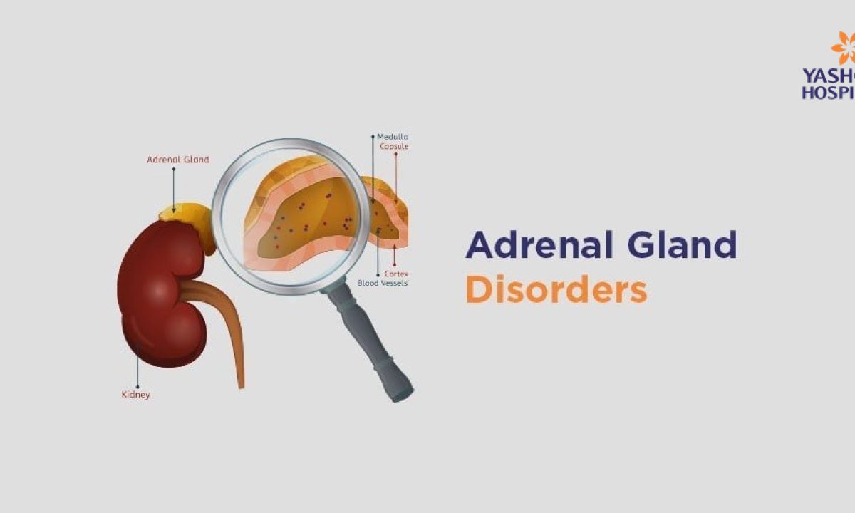 Adrenal Gland Diseases And Tumors
