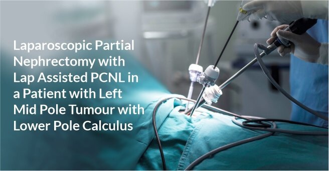 Laparoscopic Partial Nephrectomy with Lap Assisted PCNL in A Patient ...