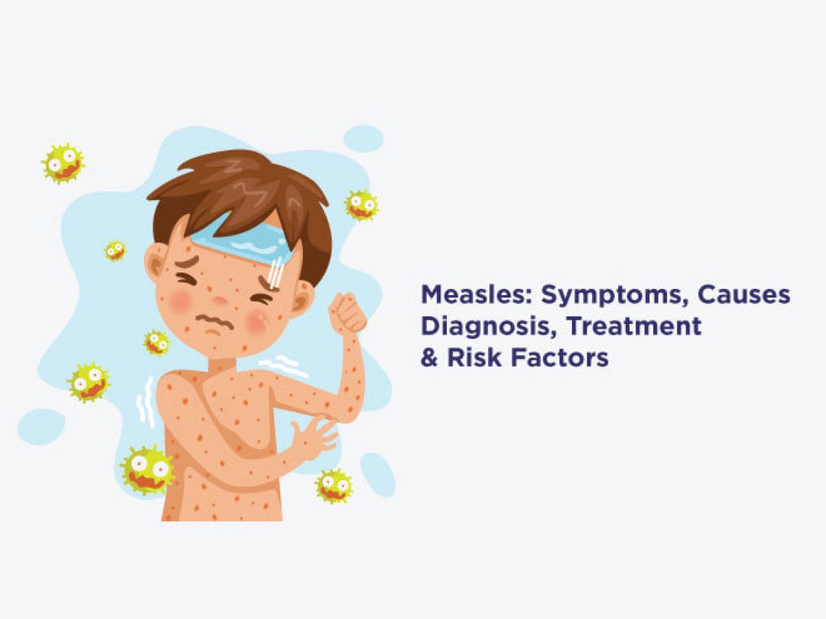 Symptoms Of Rubella Measles Timeline Revealed – All Symptoms Of