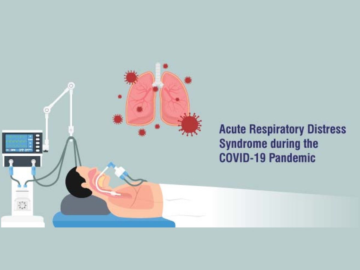 Acute Respiratory Distress Syndrome Bioinformatics Insights Into Acute