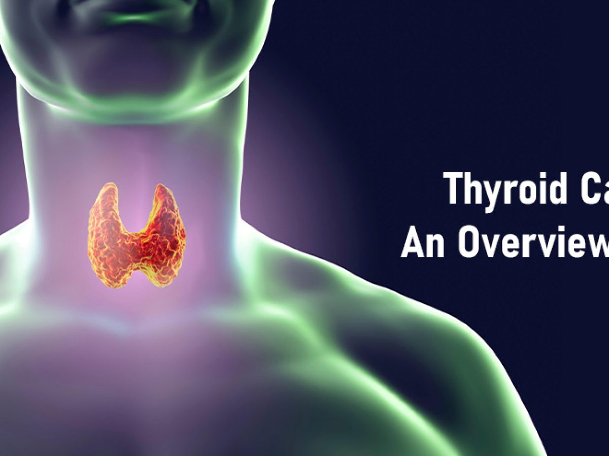 Malignant Papillary Thyroid Cancer Biologic And Clinical Perspectives