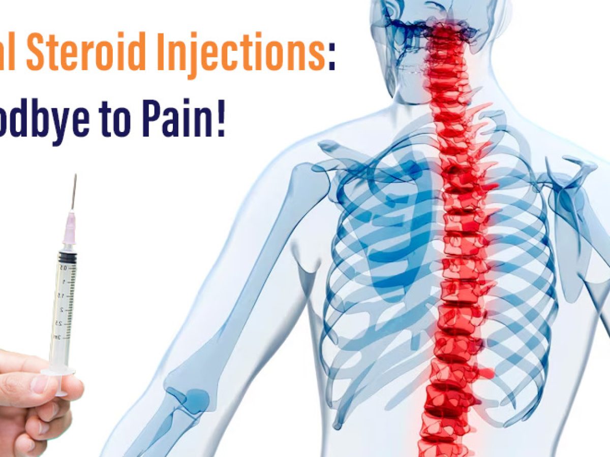 Epidural Steroid Injection Needle Cervical Epidural Steroid Injection