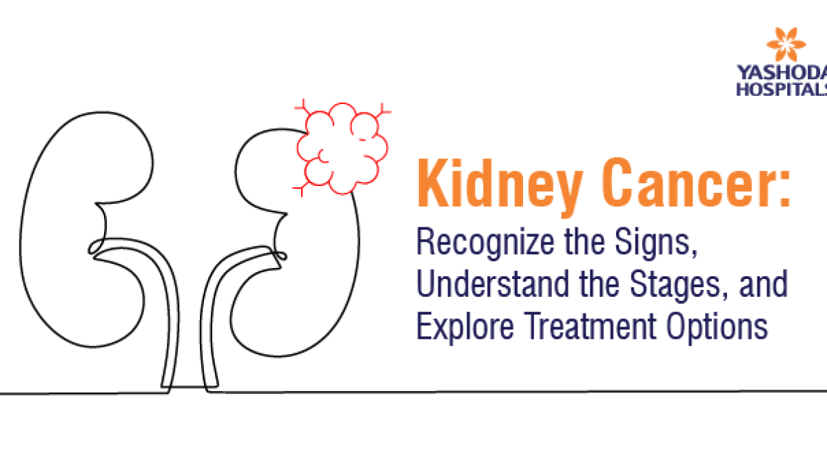 Kidney Cancer Symptoms Causes Diagnosis And Treatment