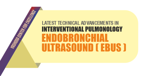 Endobronchial Ultrasound (Ebus) - Yashoda Hospitals