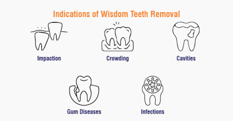 Wisdom Teeth Removal: Indications, Procedure and Recovery