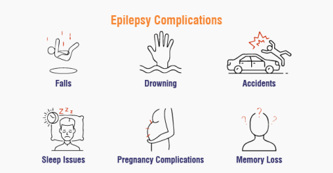 Epilepsy: Symptoms, Types, Causes & Treatment Options