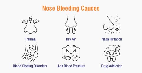 Nose Bleeding: Symptoms, Causes, Treatment and Prevention