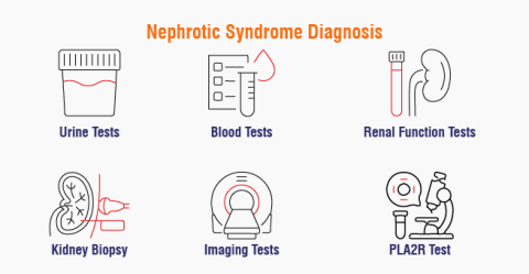 Understanding Nephrotic Syndrome: Causes, Symptoms, Diagnosis & Treatment