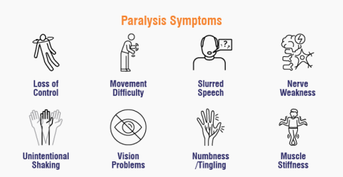 Paralysis Attack: Causes, Symptoms, Types and Treatment Options