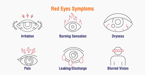 Red Eyes: Its Causes, Symptoms, and Treatment Options
