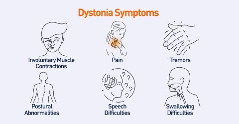 Understanding Dystonia: Symptoms, Causes, Treatment & Management Strategies