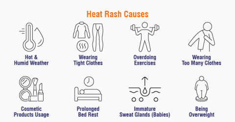 Heat Rash: Symptoms, Causes, Treatment & Prevention Tips