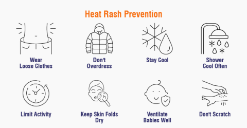 Heat Rash: Symptoms, Causes, Treatment & Prevention Tips
