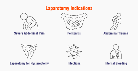 What Is a Laparotomy? Types, Procedure, Benefits, Risks & Recovery