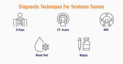 Tératomes : causes, types, symptômes, traitement et guérison