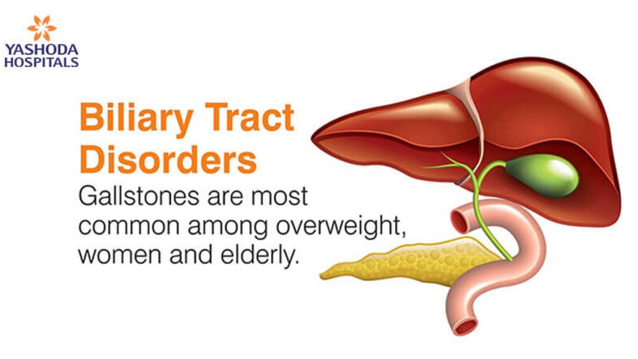 Biliary Tract Disorders