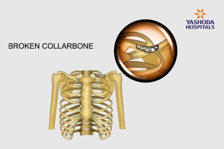 Human Collarbone
