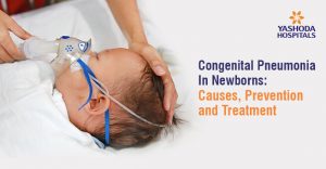 Congenital Pneumonia In Newborns: Causes, Prevention And Treatment