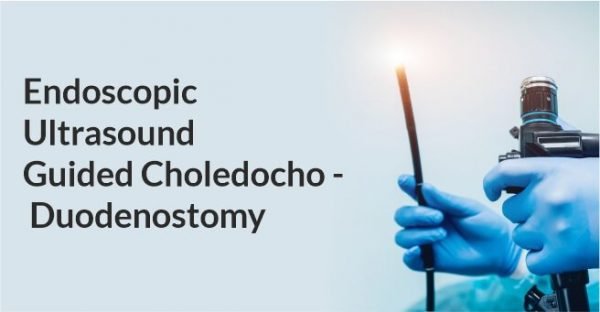 Endoscopic Ultrasound Guided Choledocho -Duodenostomy - Yashoda Hospitals