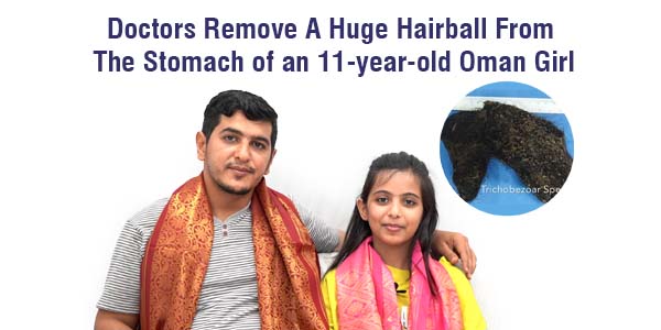 Doctors Remove A Huge Hairball From The Stomach of an 11-year-old Oman Girl