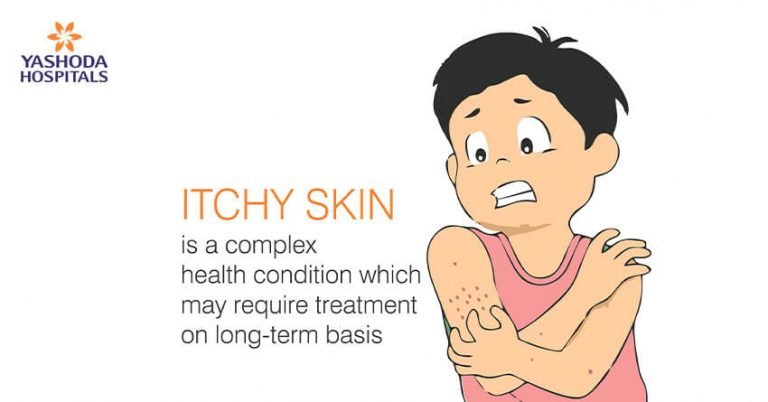 What causes itching under the skin? The Symptoms, Diagnosis and Treatment