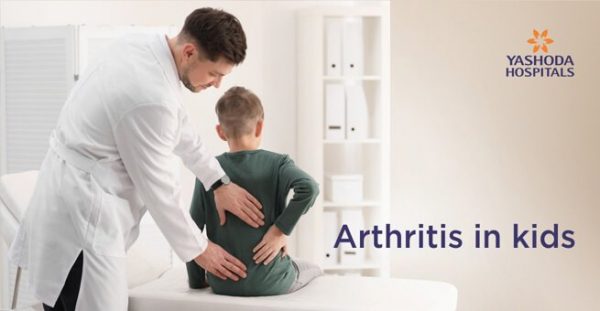 Juvenile Arthritis: Symptoms, Diagnosis, and Treatment
