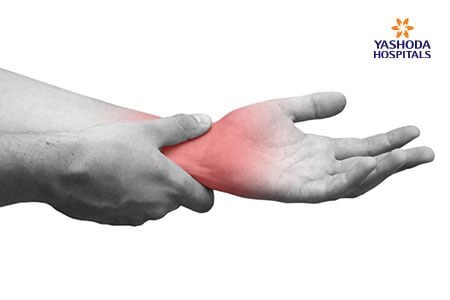 Kienbock’s Disease: What is Kienbock’s Disease, its Causes?