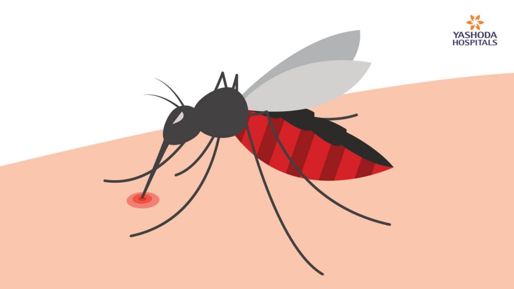 (Tropical Fever)ట్రాపికల్ ఫీవర్ - రకాలు, కారణాలు, నివారణ చిట్కాలు