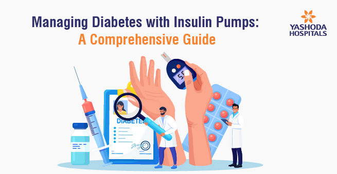 Insulin Pumps and CGM Sensors: Effective Diabetes Management