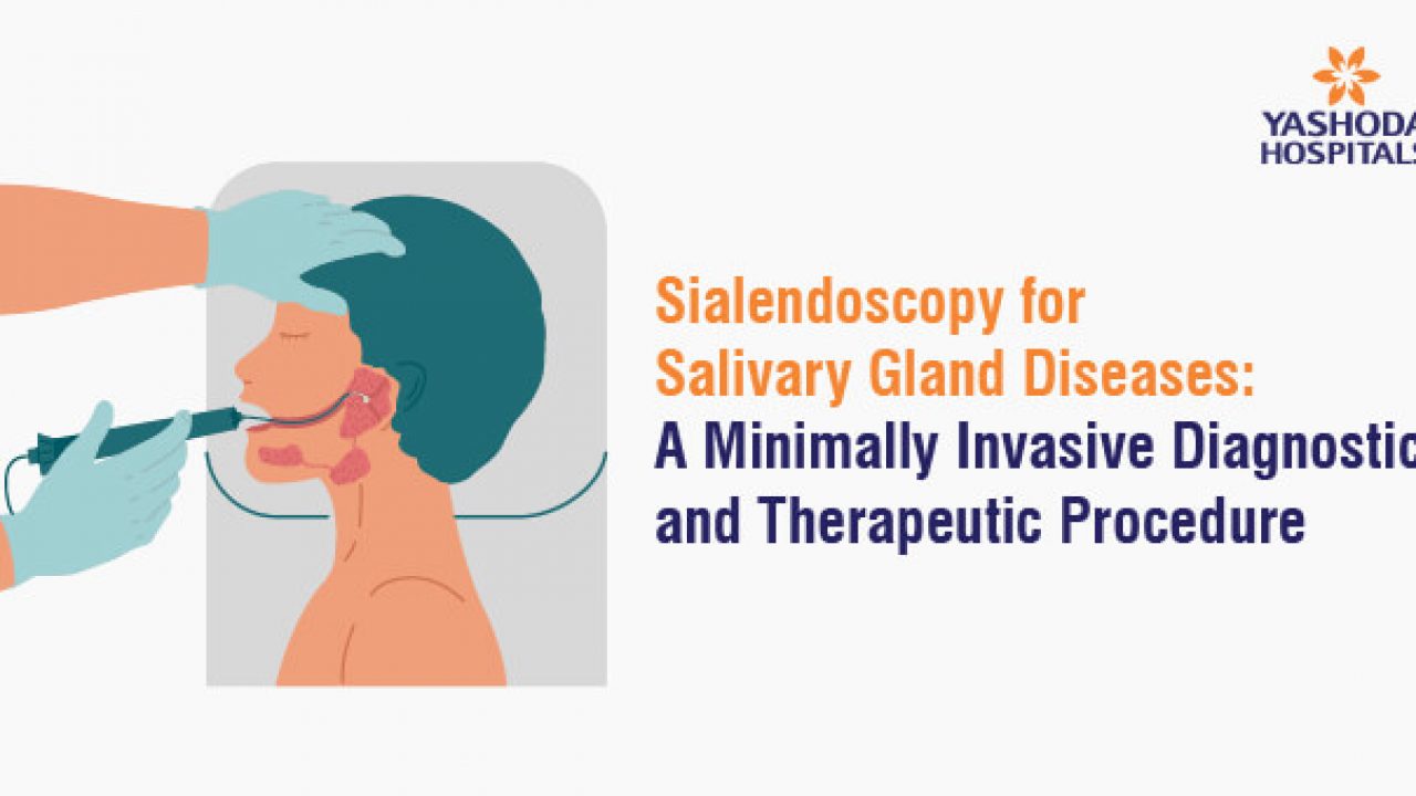 Parotid Gland Swelling