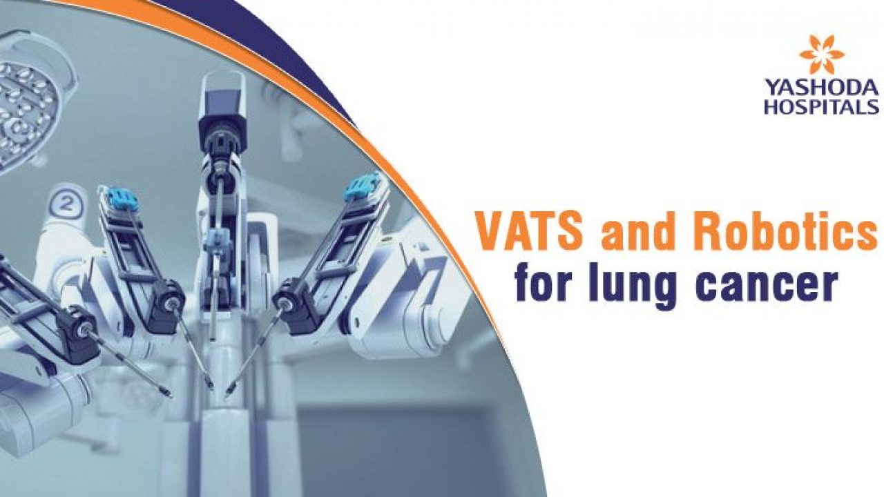 Vats Lung Cancer