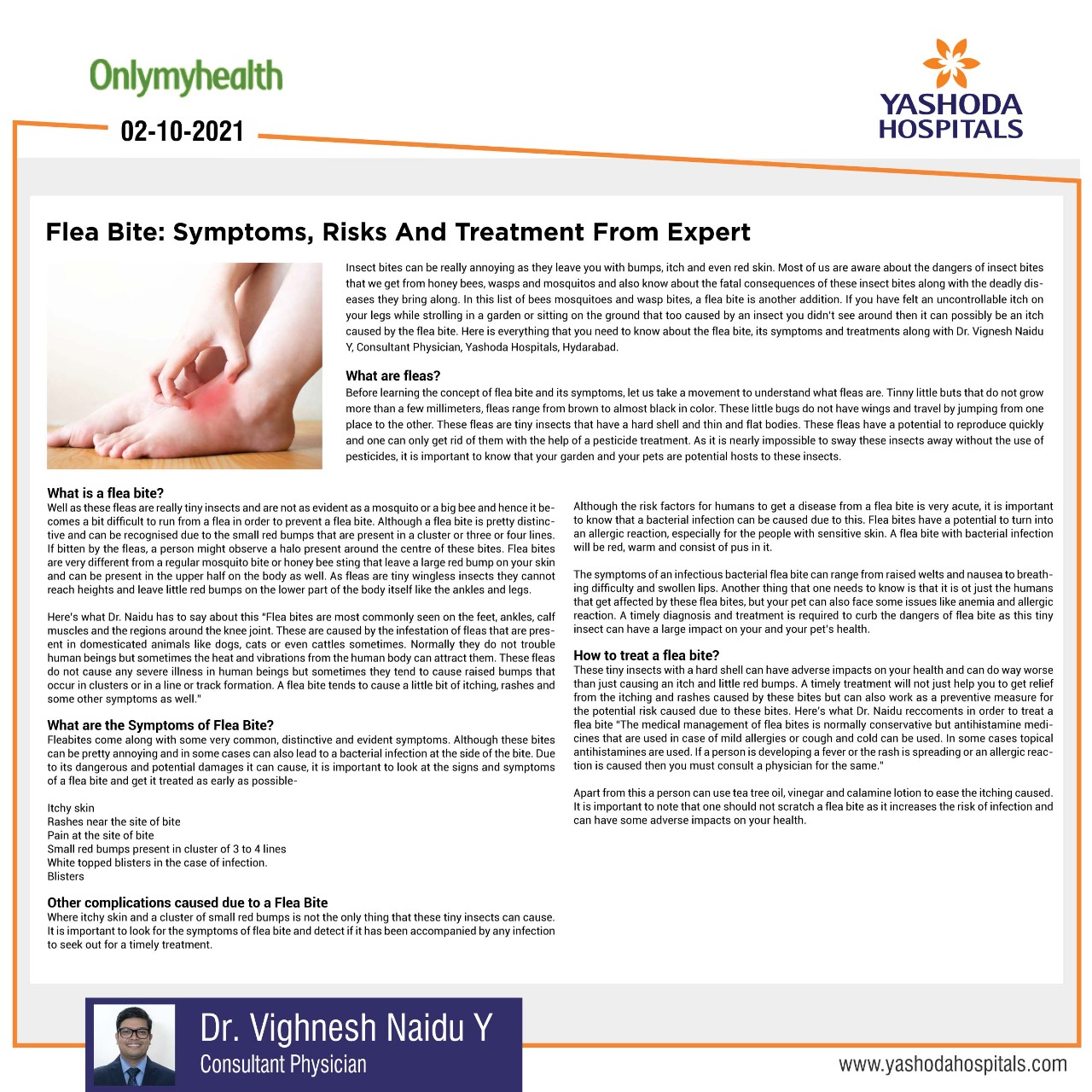 All you need to know about Flea Bites- Dr. Vighnesh Naidu Y - Yashoda ...