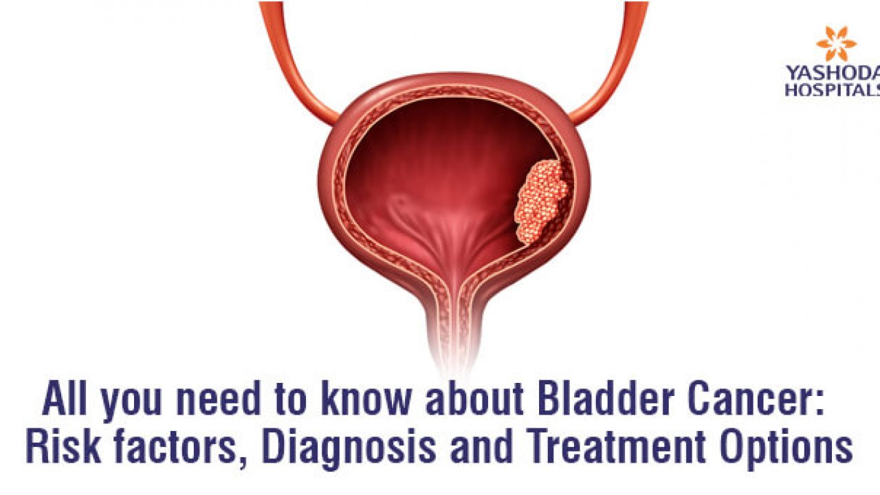Bladder Cancer Treatment
