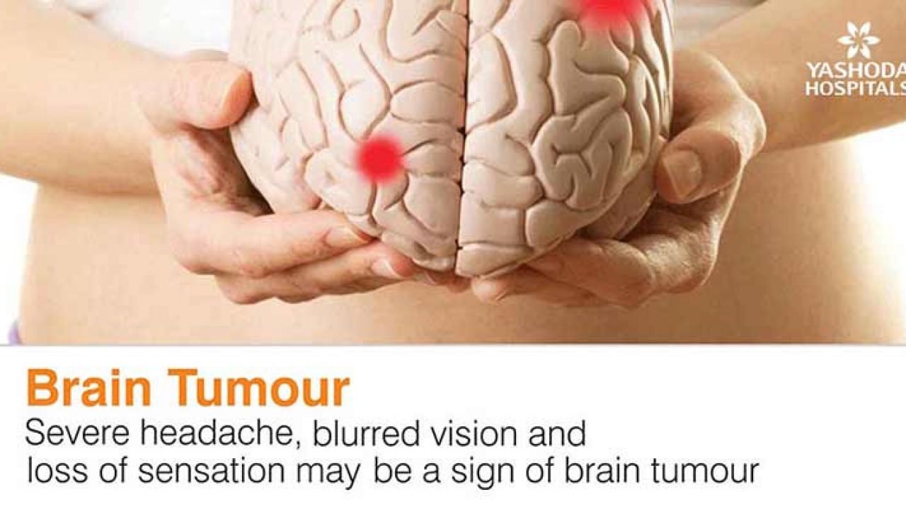 Brain Tumor Causes And Symptoms