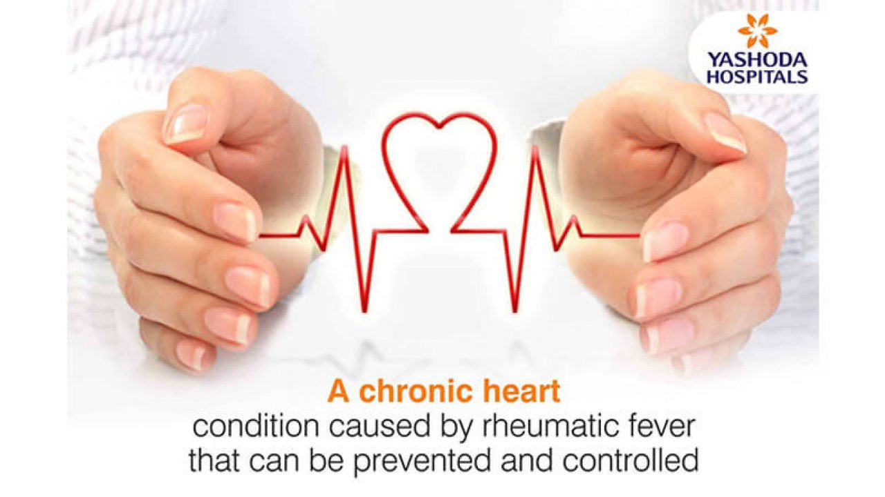 Rheumatic Fever