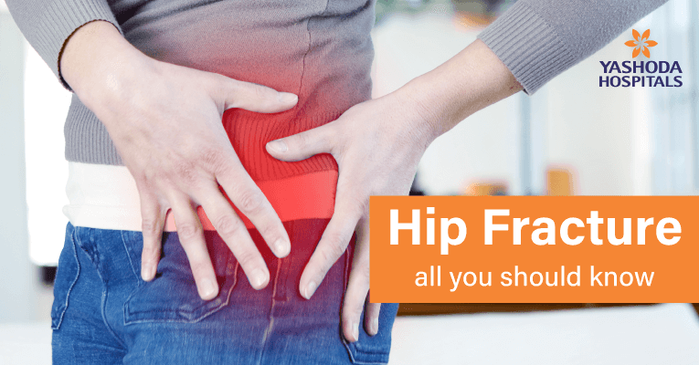 How to treat hip fractures?