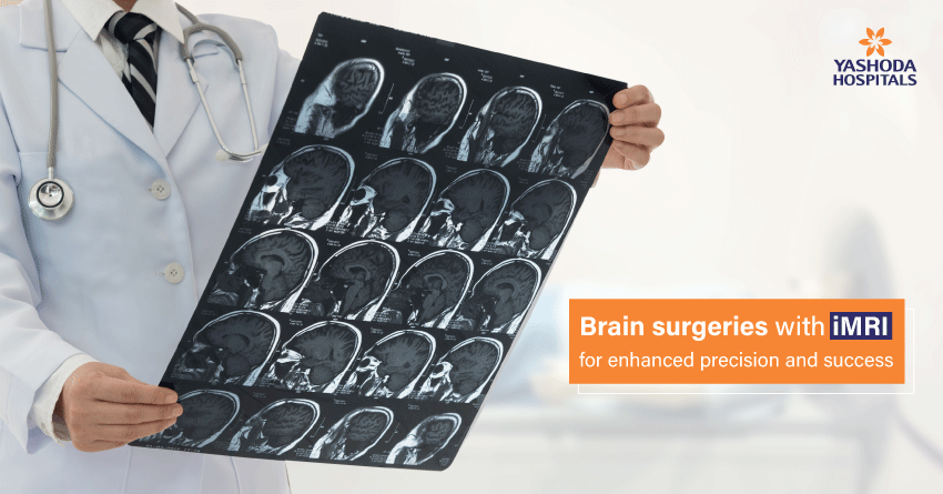 Intraoperative MRI (iMRI) for Brain Surgery in India.