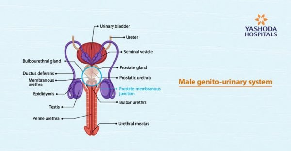 Male urethral stricture - The disease is as old as humanity - Yashoda ...