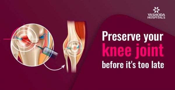 Knee Joint Preservation: Why and how its done?