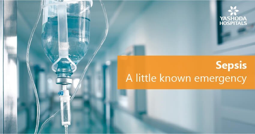 Sepsis: Causes, Symptoms, Complications, Risk, Diagnose and Treatment