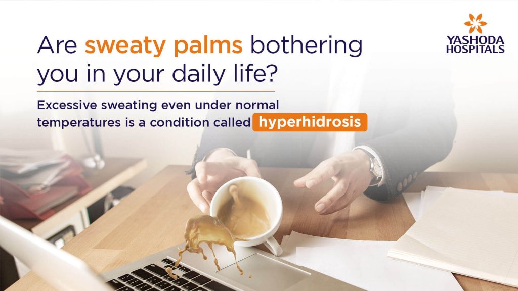 5 Signs that your sweaty palms need more care