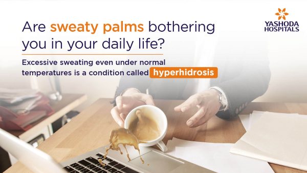 5 Signs that your sweaty palms need more care