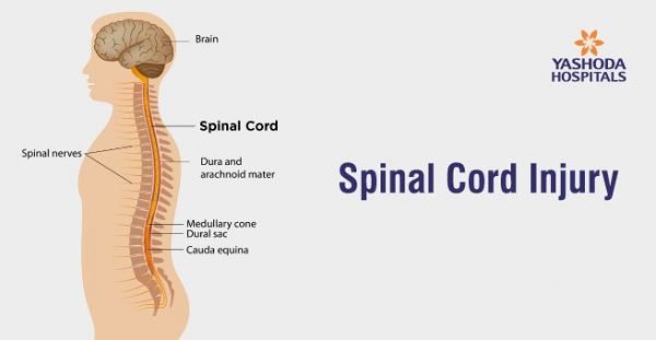 Spinal Cord Injury: Types, Causes, Symptoms, Diagnosis and Treatment